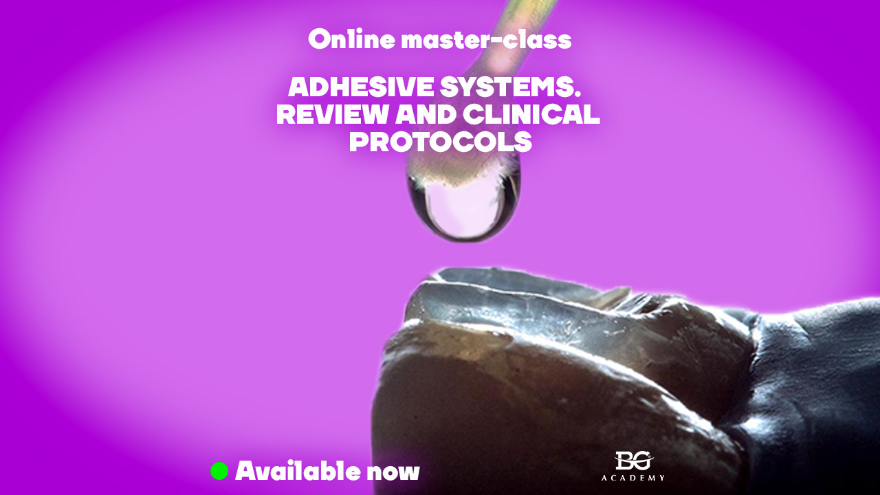 Adhesive systems. Review and clinical protocols. Webinar. Theory and ...