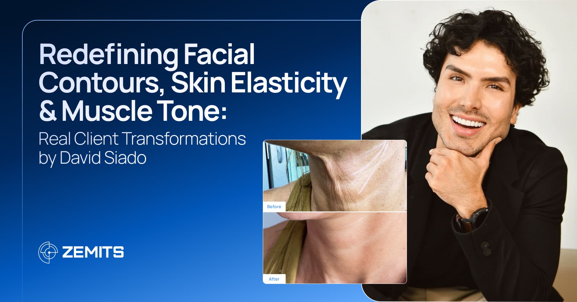 Redefining Facial Contours, Skin Elasticity & Muscle Tone