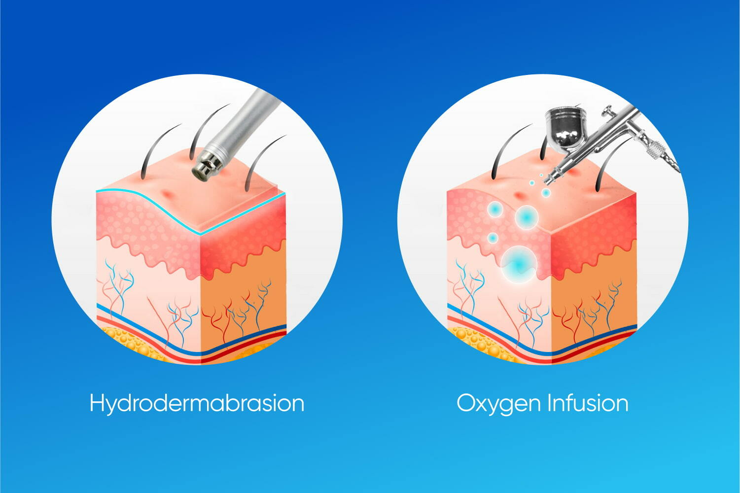 Zemits HydroLuxx - Hydrodermabrasion & Oxygen Infusion System