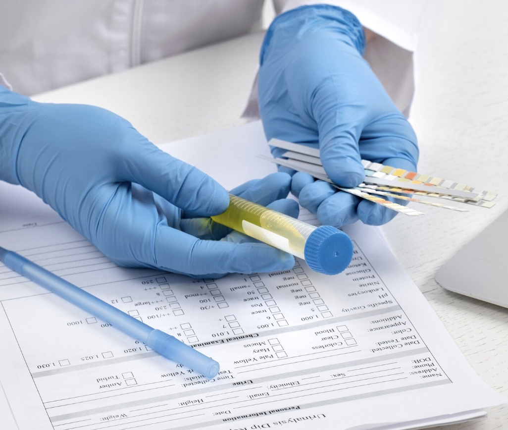 Why You Should Do a Urine Test | Vavilova Medical Center, Cyprus