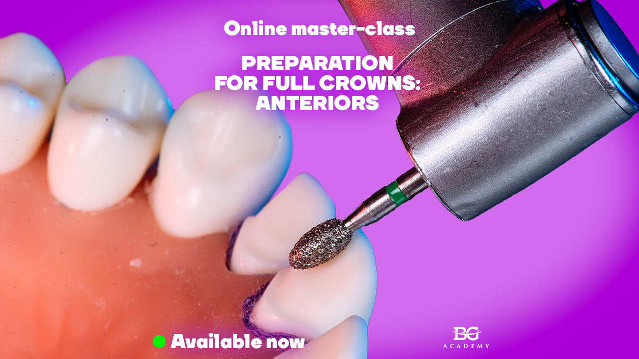 Preparation for full crowns: Anteriors