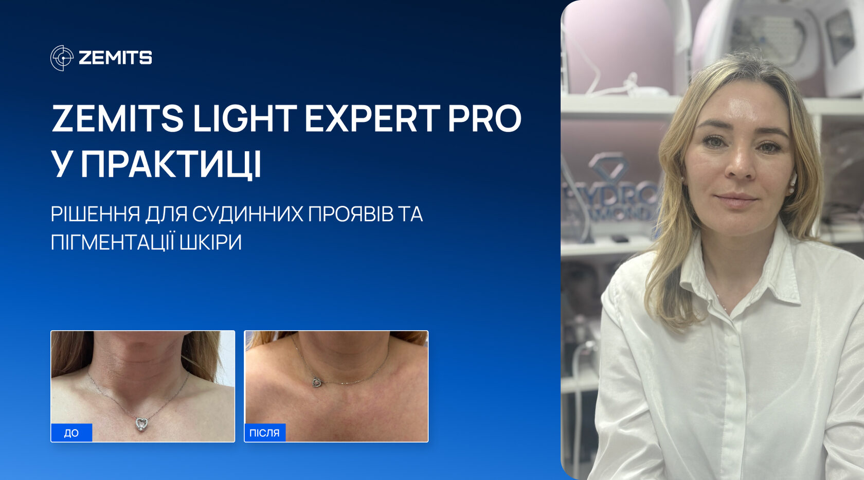 Ефективні результати з Zemits Light Expert Pro: Вражаючі рішення для ...