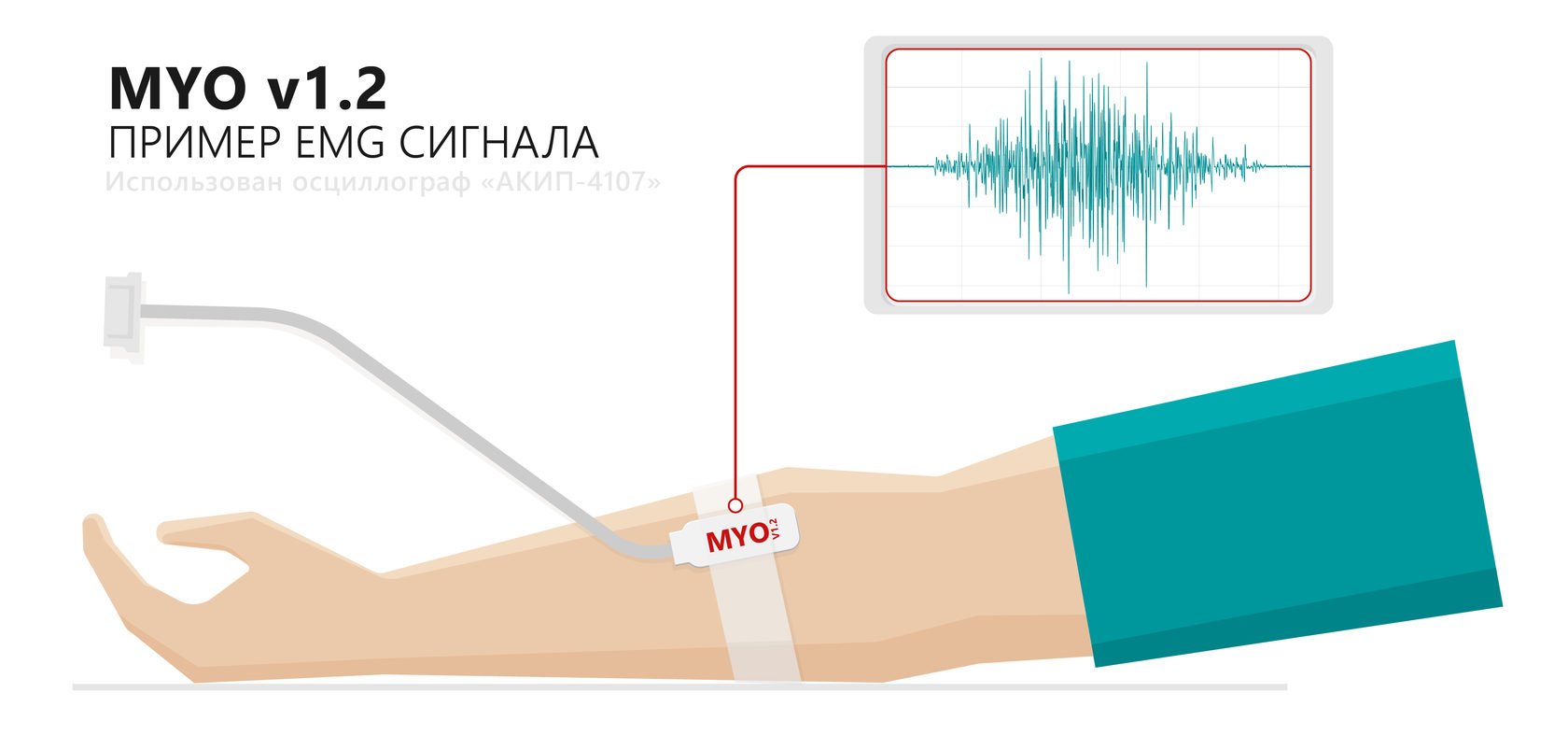Module MYO and sensor MYO-kit. Examples of EMG signals and noise ...