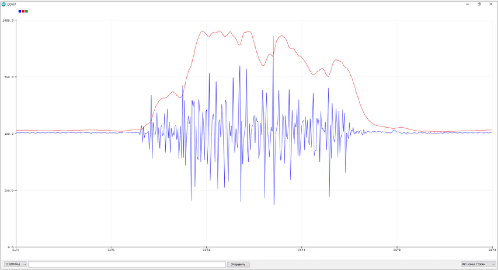 Muscle Sensor MYO v1.5: connection to Arduino