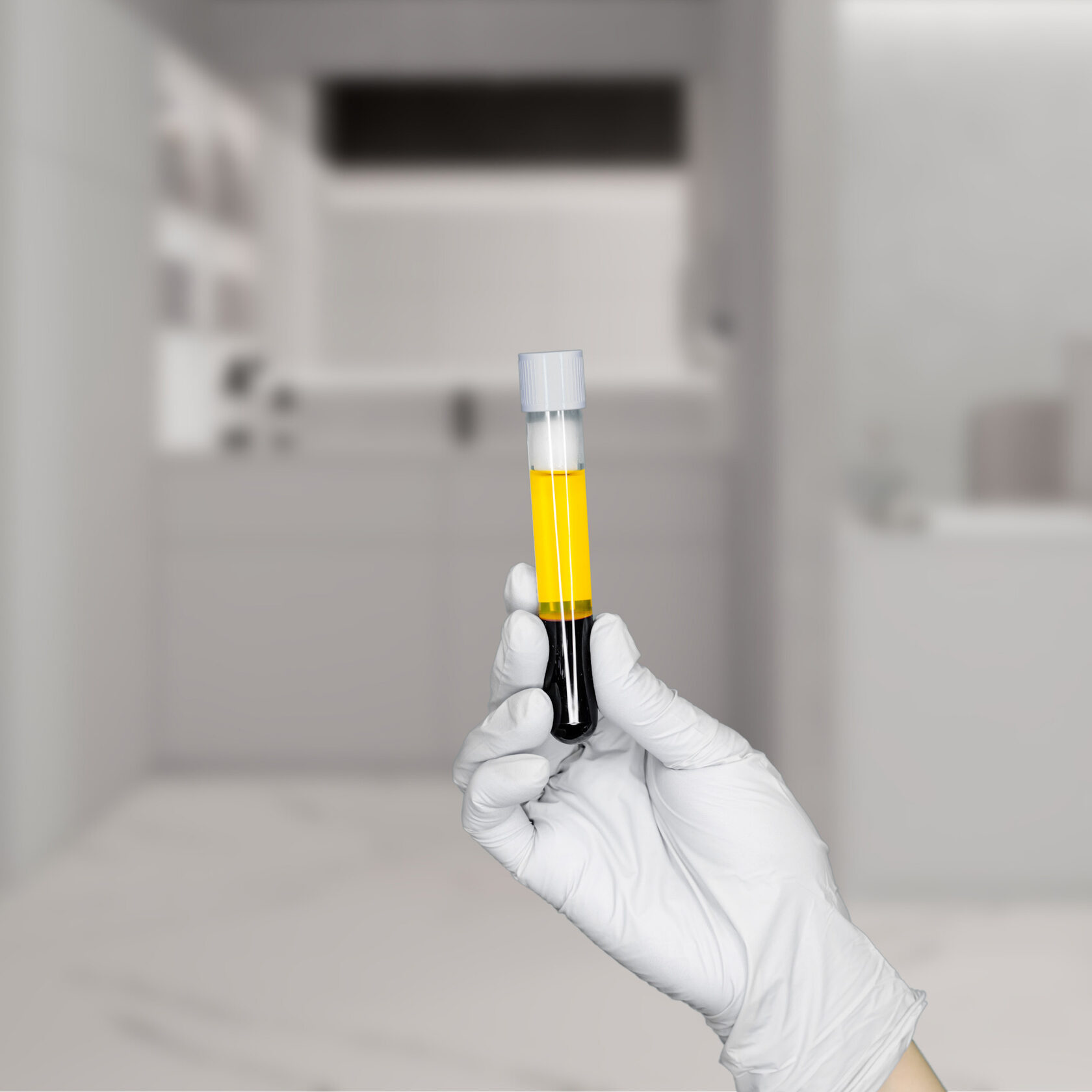 Плазмотерапія Endoret PRGF