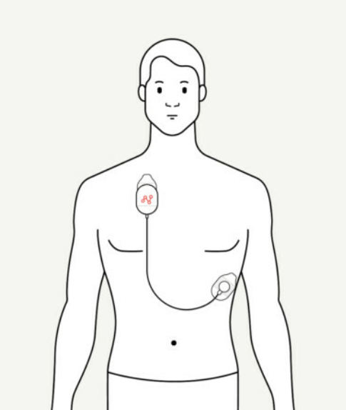 Stressi ja taastumise monitor Firstbeat Life, Bodyguard 3 I ...