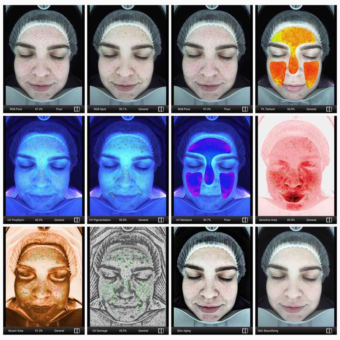 Zemits VeraFace Skin Analysis System Advance Your Expertise|Esthetic ...