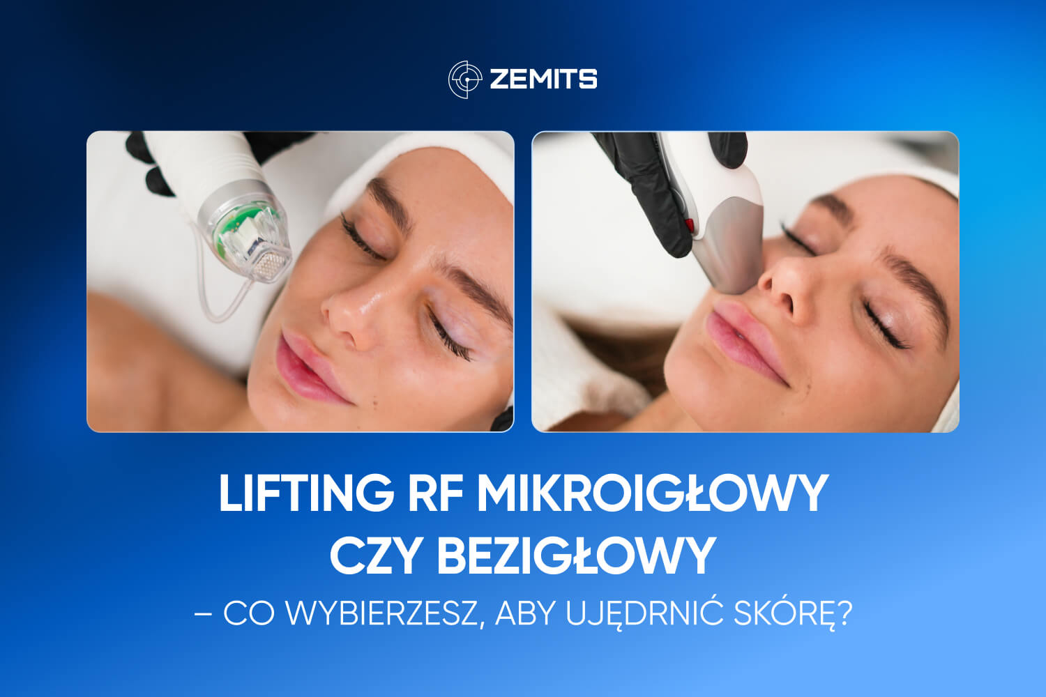 Starcie o jędrną skórę: radiofrekwencja mikroigłowa (RF) czy ...