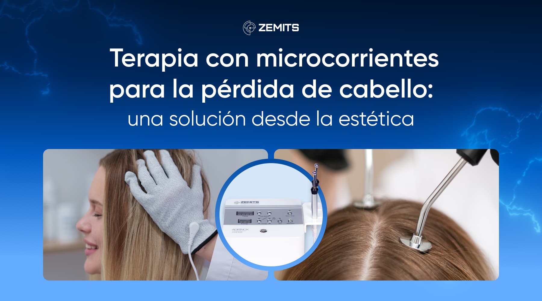 Terapia con Microcorrientes para la Pérdida de Cabello: Una Solución ...