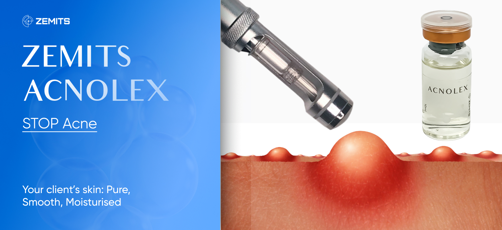 Zemits Acnolex Anti-Acne Serum for Non-injection Mesotherapy ...