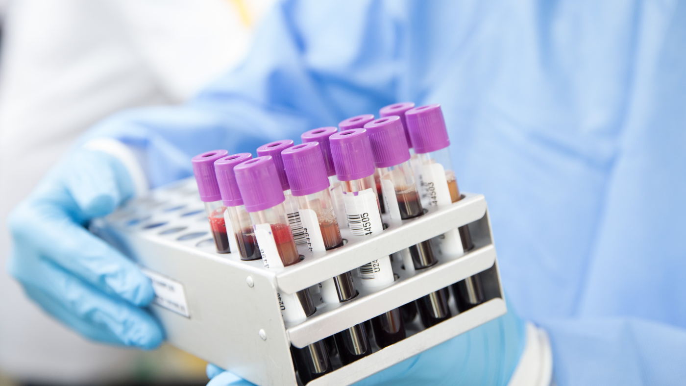 What Do My Blood Test Results Mean? Explained Simply (2025 -2026 Guide)