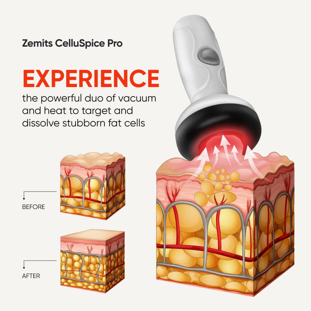 Zemits CelluSpice Pro Thermal Body Sculptor | Esthetic Spa Equipment ...